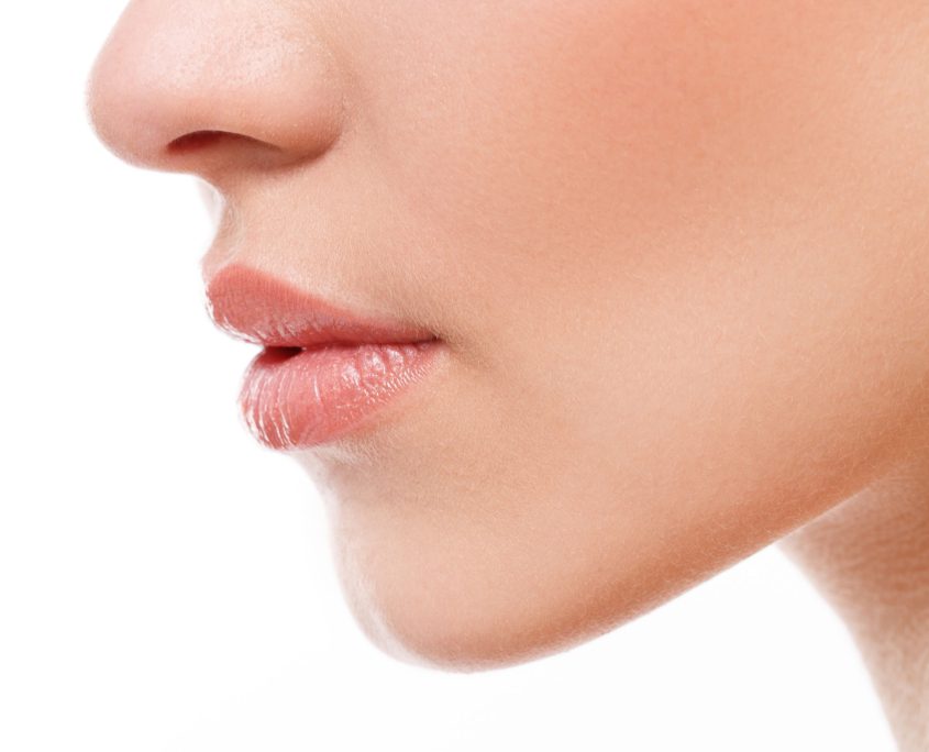 Elevación del labio superior - Clinica Mayol